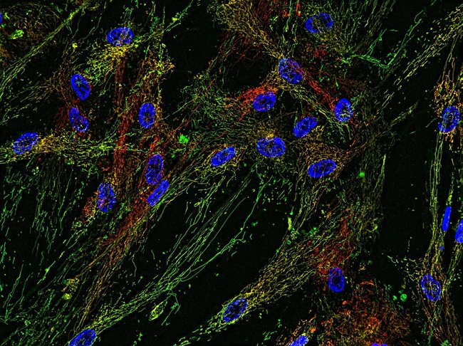 Live Cell | Scientific Volume Imaging