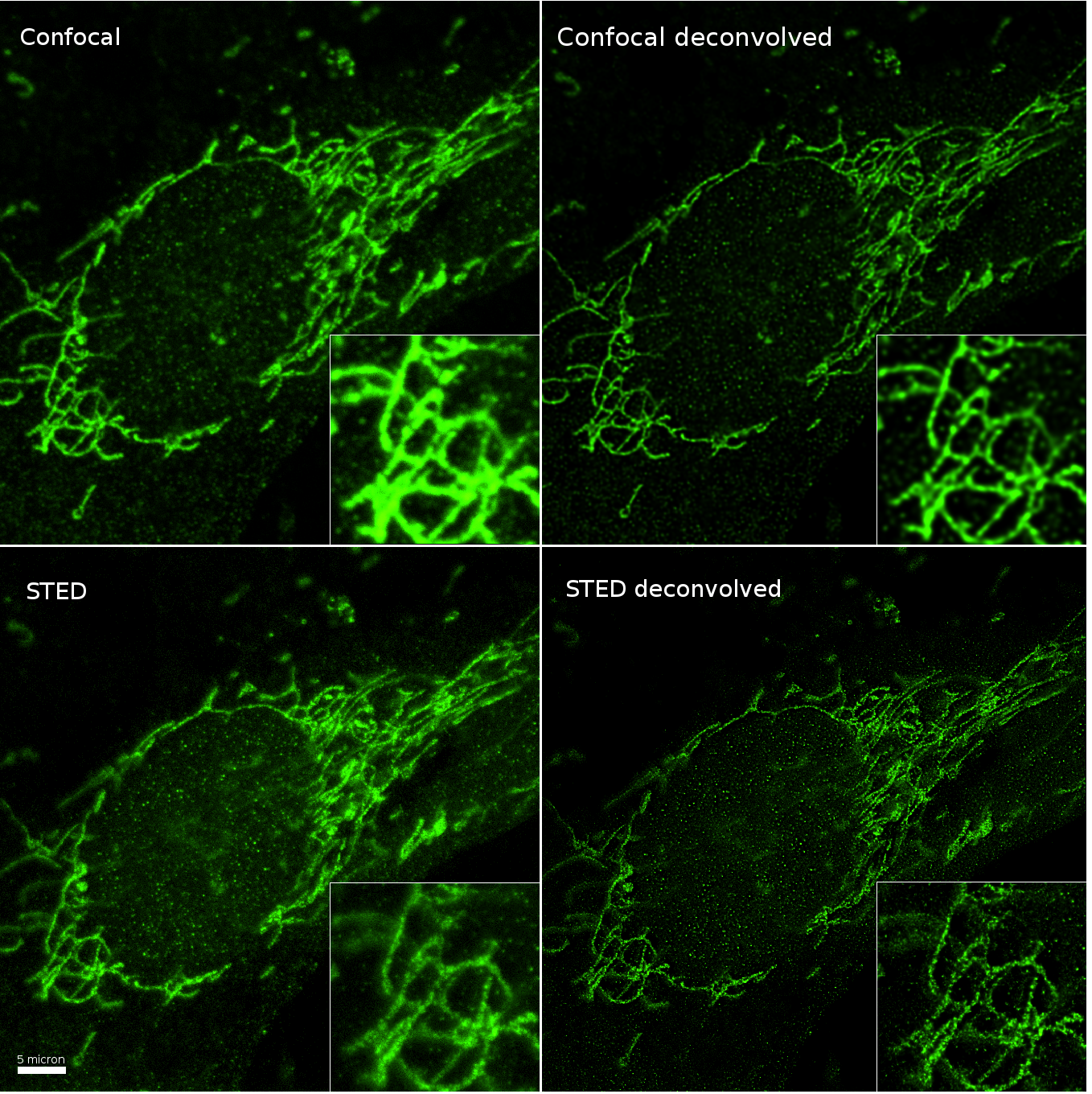 Neurosciences | Scientific Volume Imaging