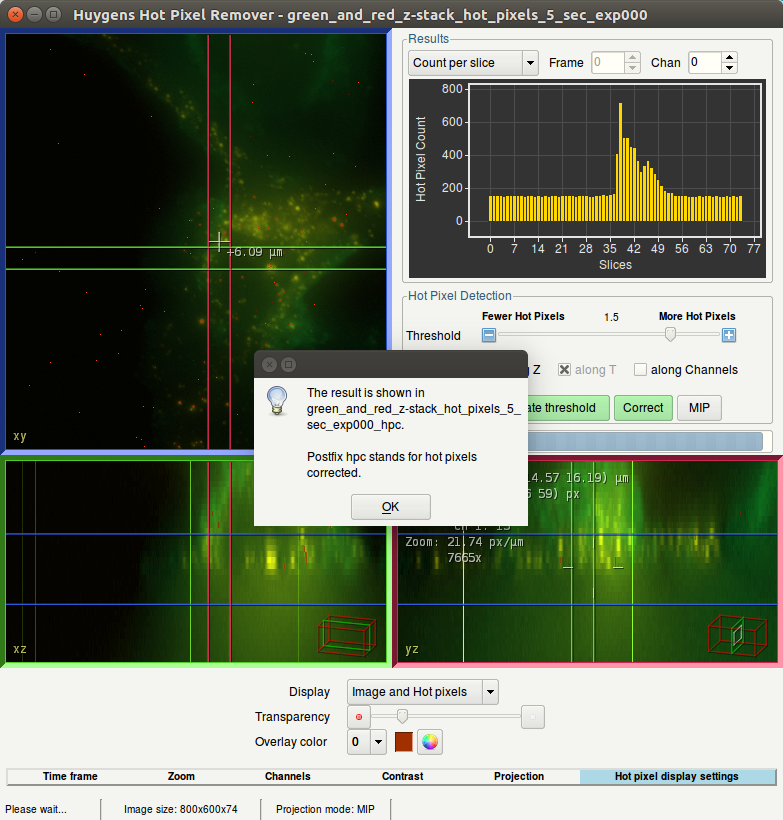 HotPixelRemover | Scientific Volume Imaging