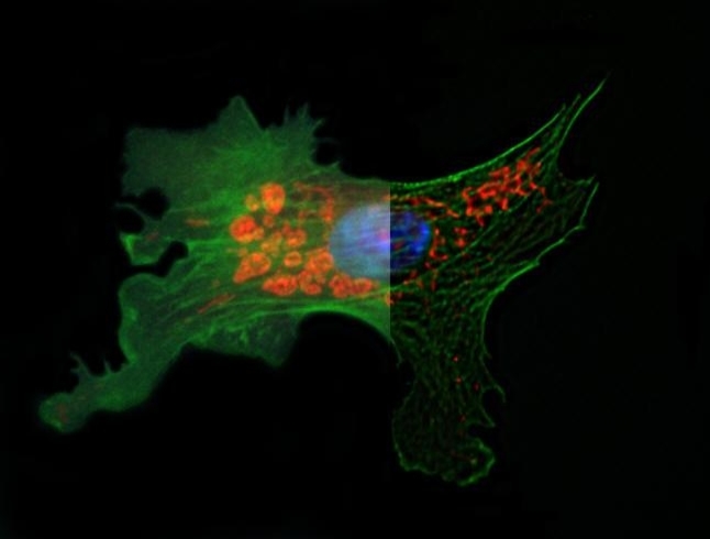 Huygens Deconvolution | Scientific Volume Imaging