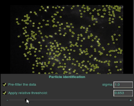 Huygens Localizer | Scientific Volume Imaging