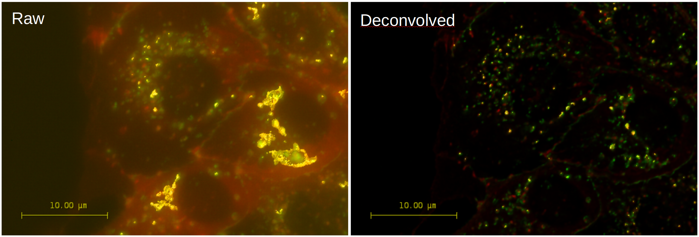 ColocalizationBasics | Scientific Volume Imaging