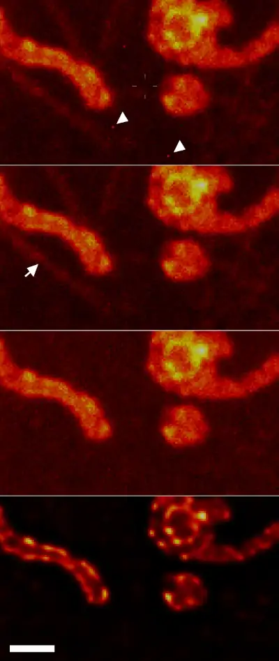 Huygens Rescan Software | Scientific Volume Imaging