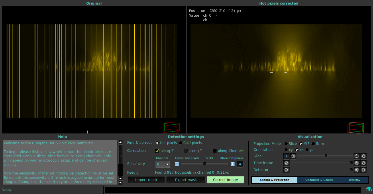 Pixel Remover Support | Scientific Volume Imaging